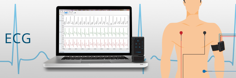 Ecg Signal Monitoring
